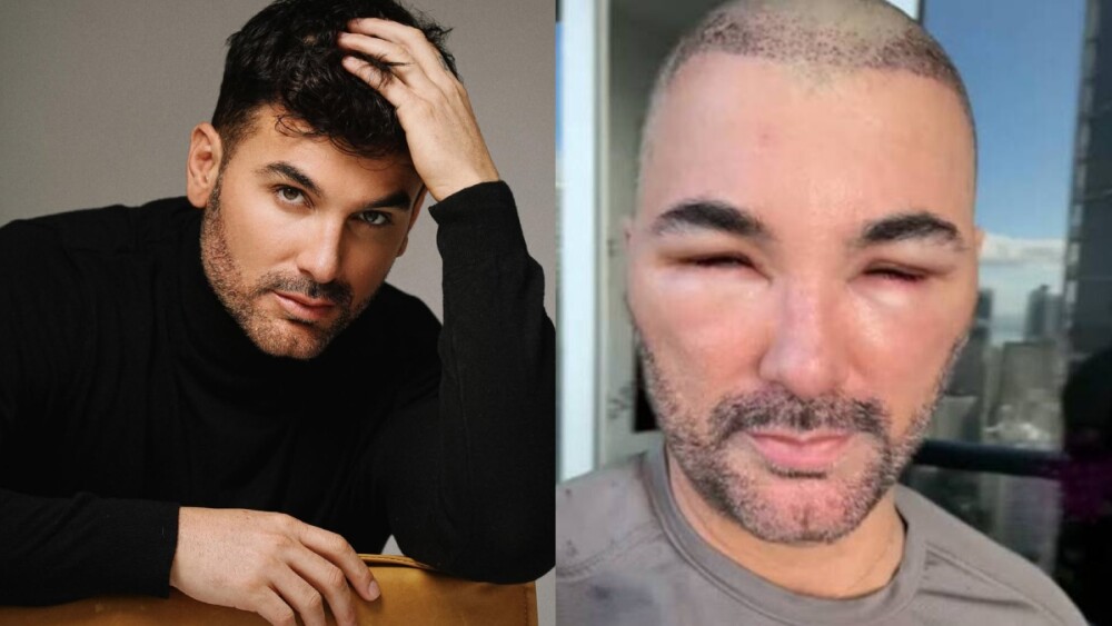 Un actor mexicano causó horror al reaparecer completamente ...